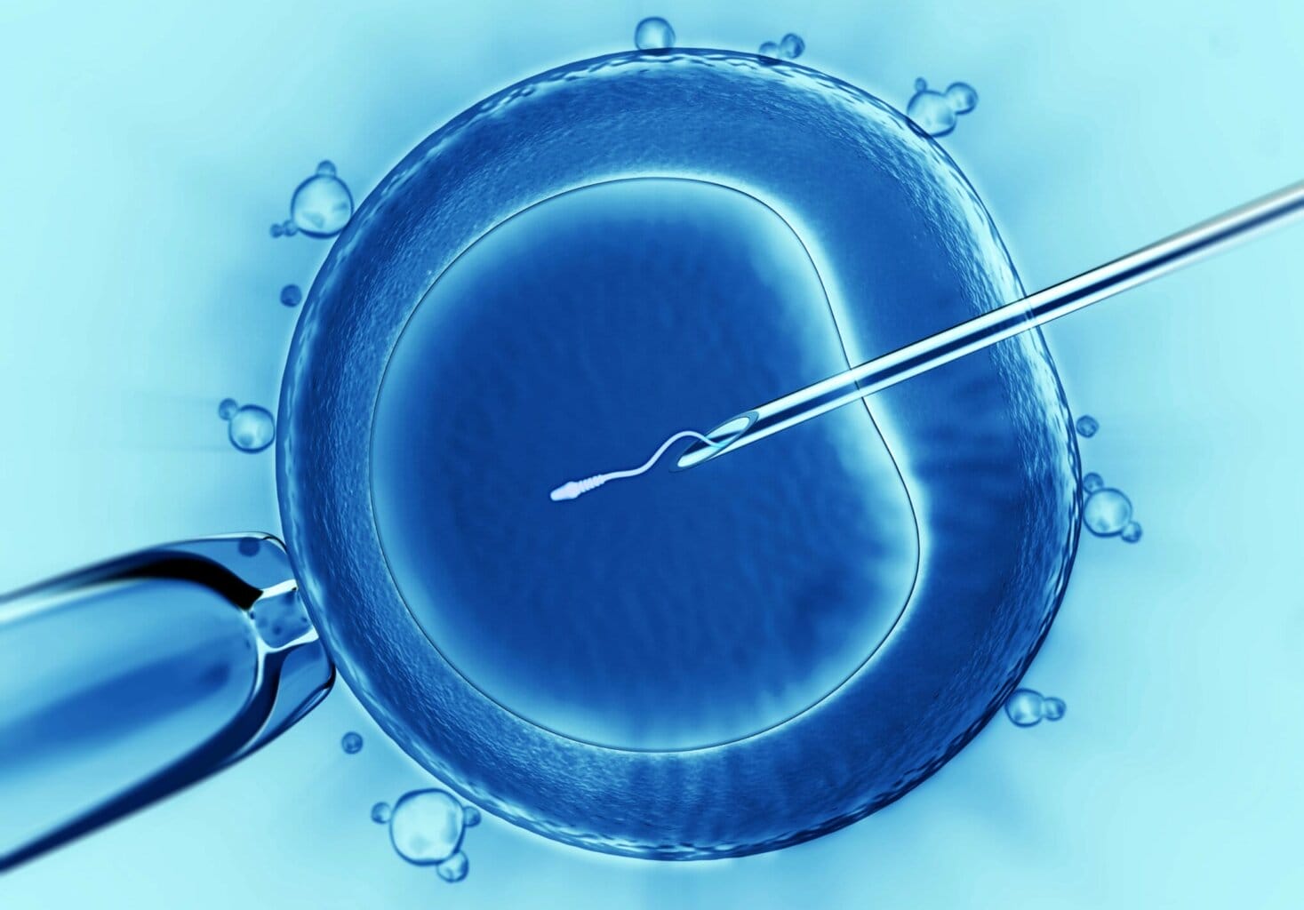Künstliche Befruchtung - IVF/ICSI - Methoden, Ablauf, Chancen